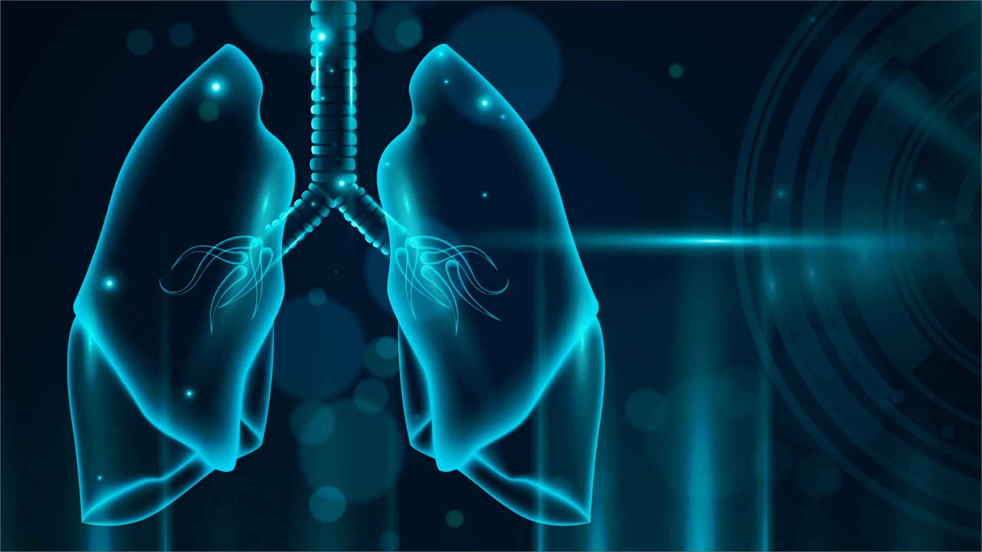Lung Cancer Screening | Minimally Invasive Cardiothoracic Surgery